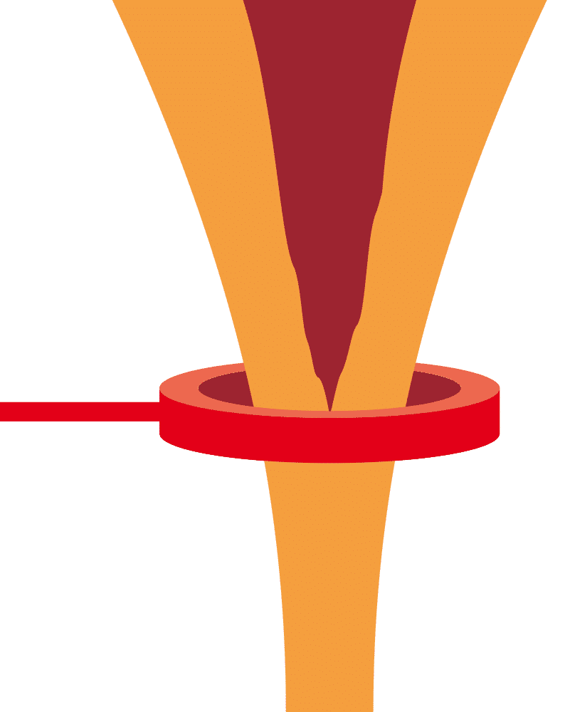 AMEPA - Electromagnetic Slag Detection (ESD)